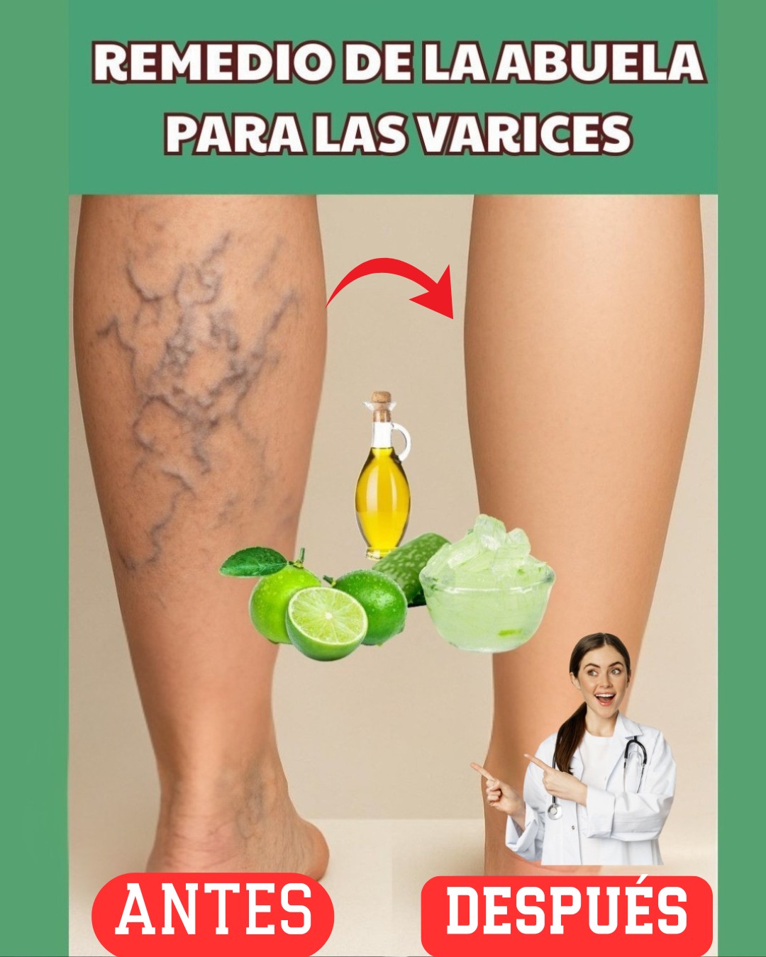 Remedio de la Abuela para las Várices: Receta Natural con Aloe Vera ...